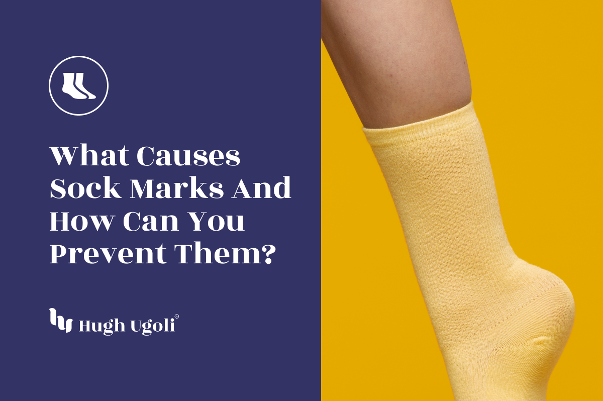 What Causes Sock Marks and How Can You Prevent Them? | Hugh Ugoli Socks